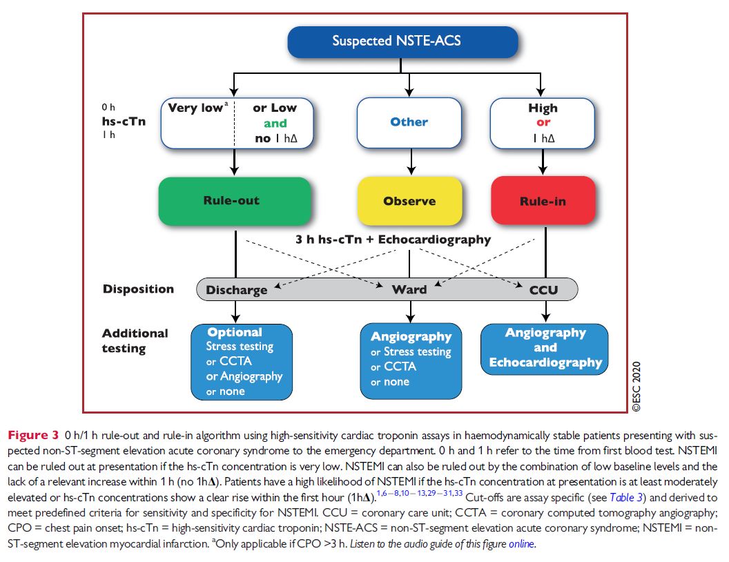 Interpretationshilfen bei Verdacht auf akutes Koronarsyndrom (ACS ...